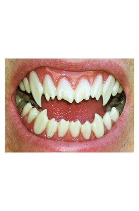 Dental Distortions | Epic Armoury Australia