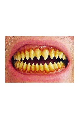 Dental Distortions | Epic Armoury Australia